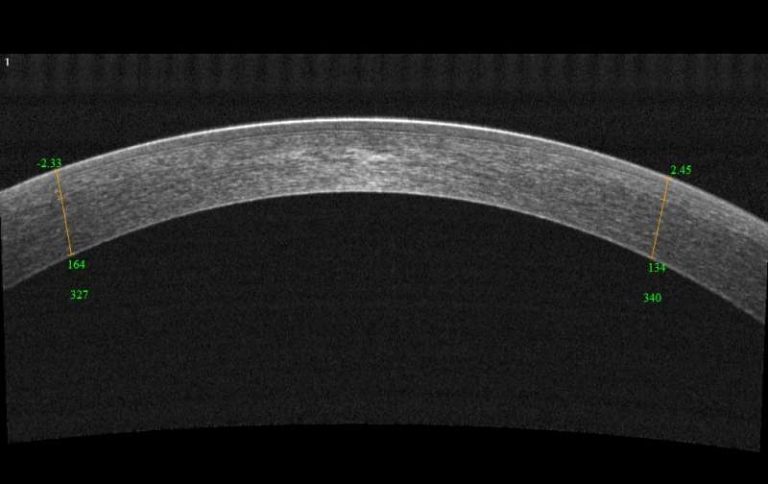 OCT by Optovue | Dynamic Eye Care